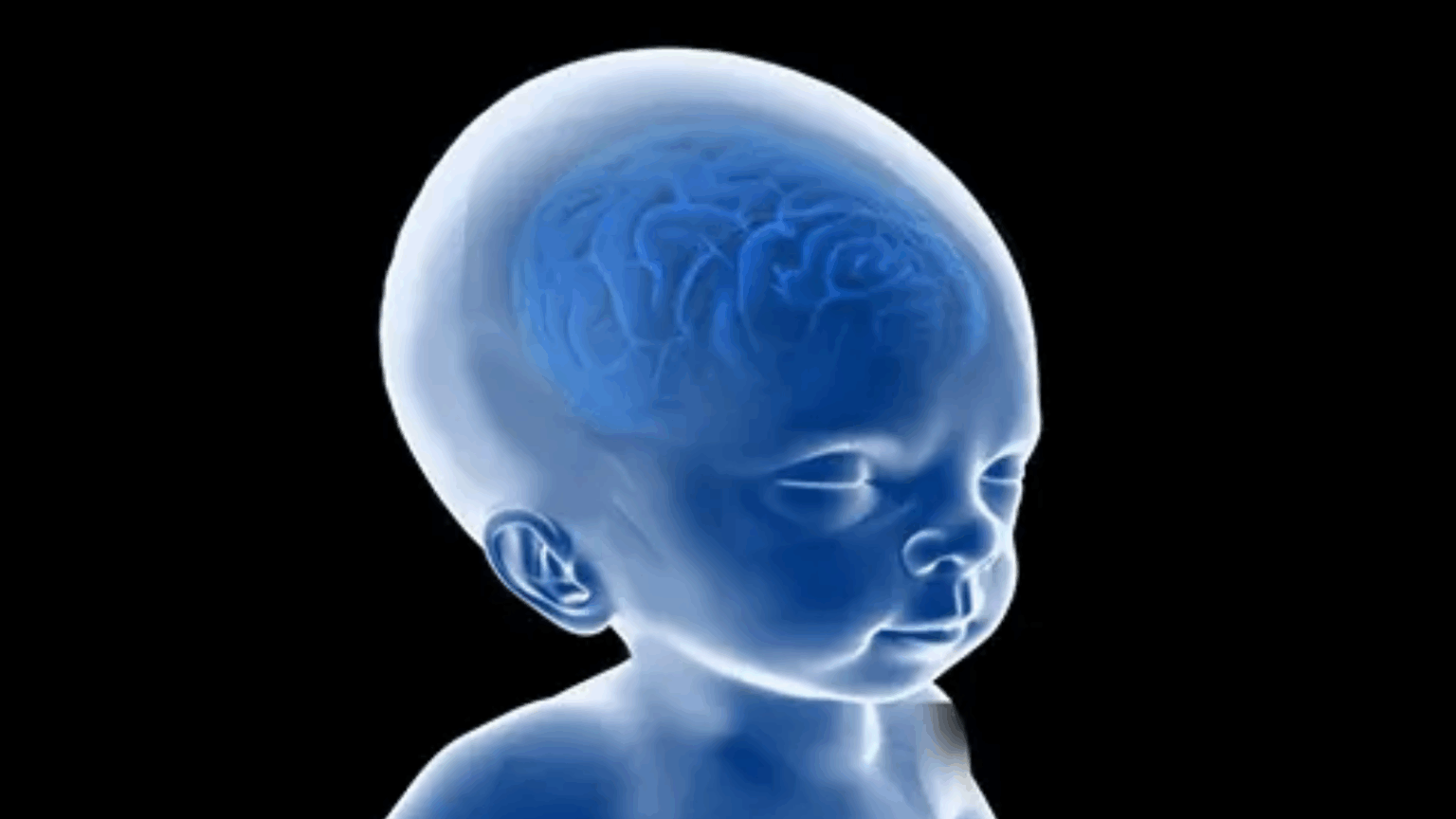 Hydrocephalus in PCMC | Spine N Brain Clinic