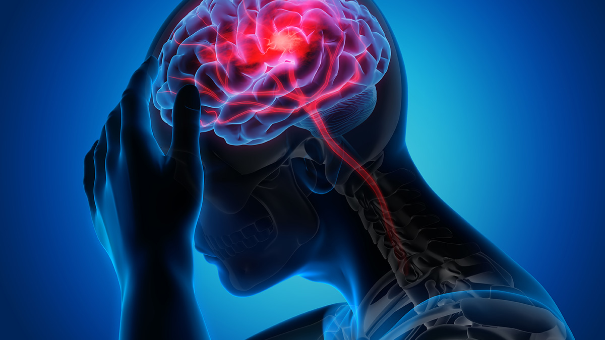Stroke Symptoms & Emergency Steps